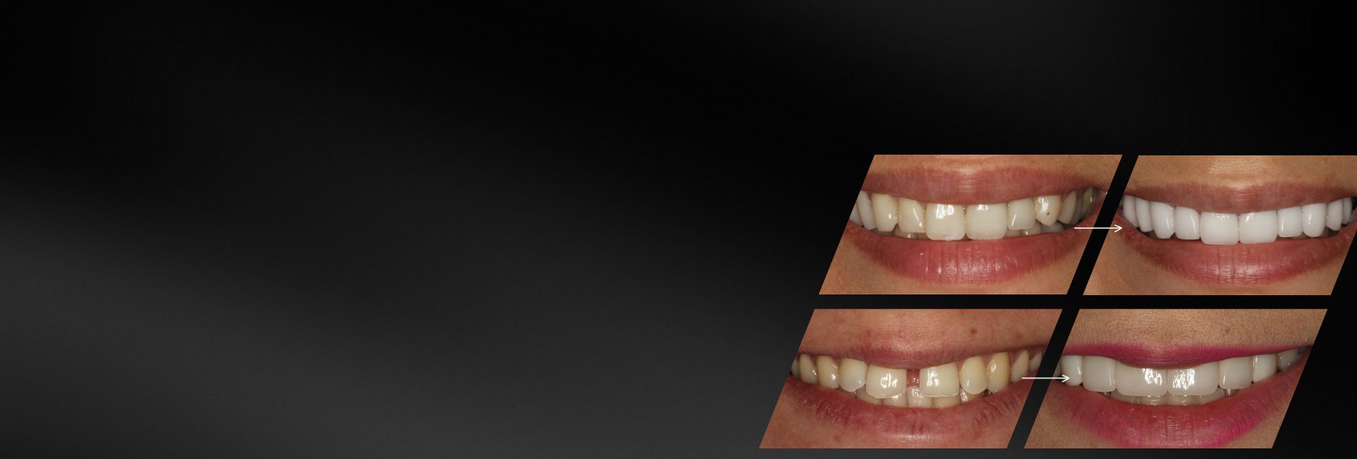 San Mateo Center for Cosmetic Dentistry | (650) 342-9016 | San Mateo CA